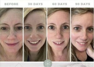 Collagen Before and After Pictures - Do you see the Difference?